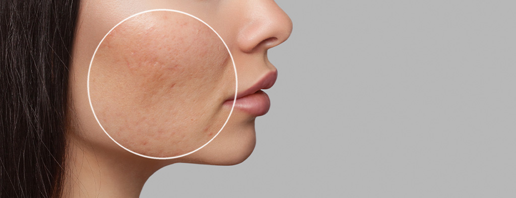 ABI Dermaceuticals’ Topical Light Infusion: A Game-Changer for ...